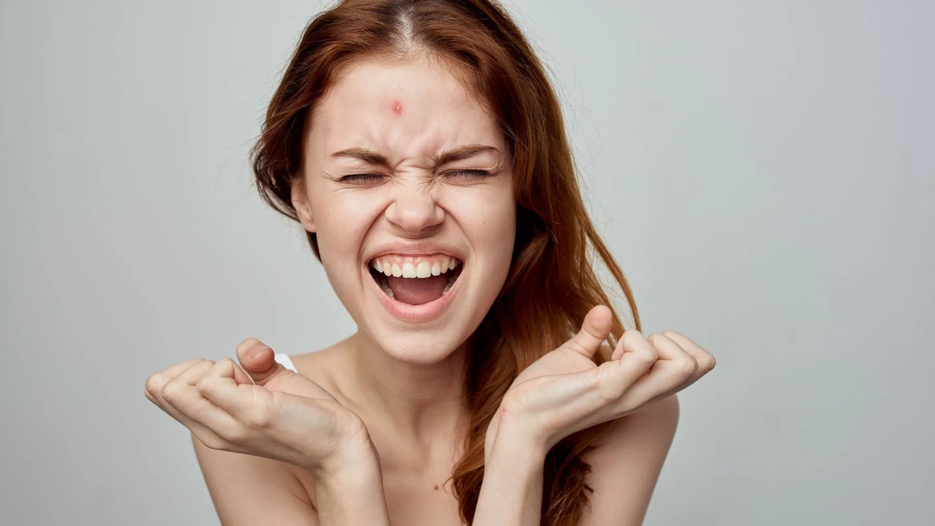 Why Do You Get Period Pimples and How Can You Treat Them? – Dr. Snug